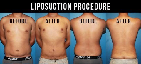 Get Abs Fast: Fake Abs are Real! The Absolute Guide